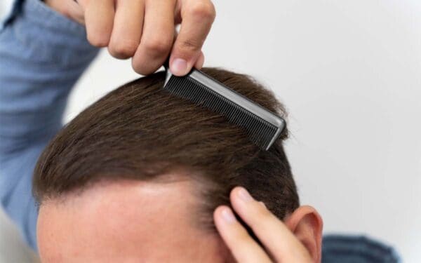 5 Ciri-Ciri Akar Rambut Mati dan Rusak Disertai Penyebabnya