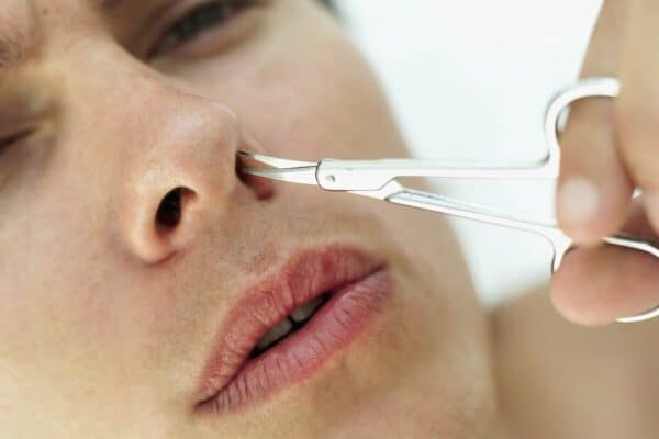 4 Cara Mencabut Bulu Hidung yang Benar, Gak Sembarangan!